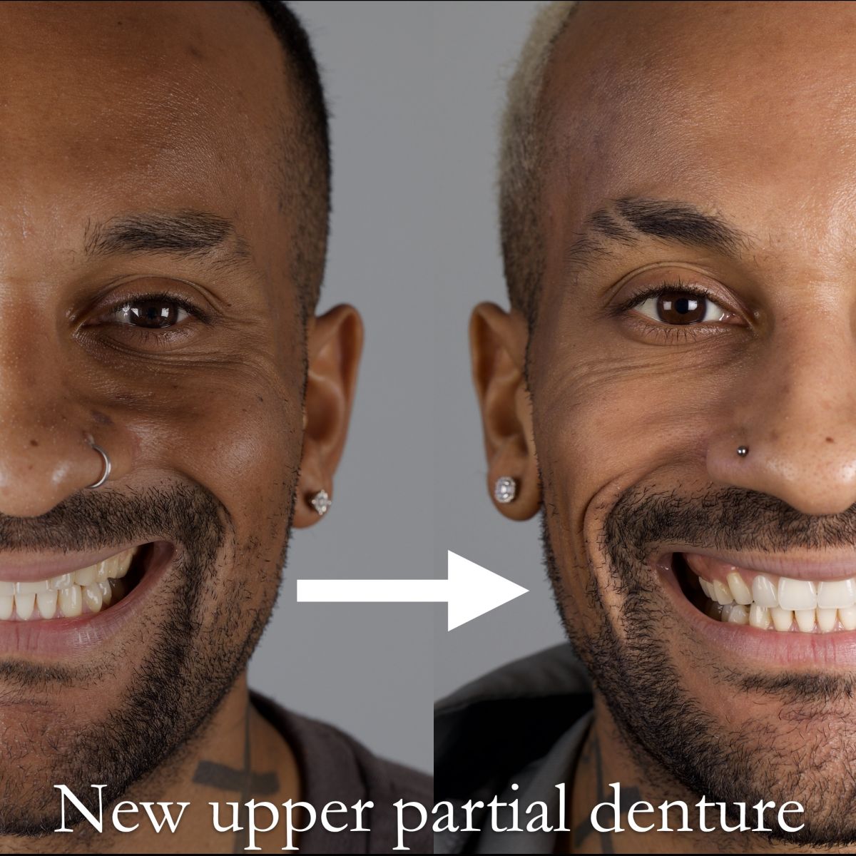 James loves his new smile | Garstang Dental