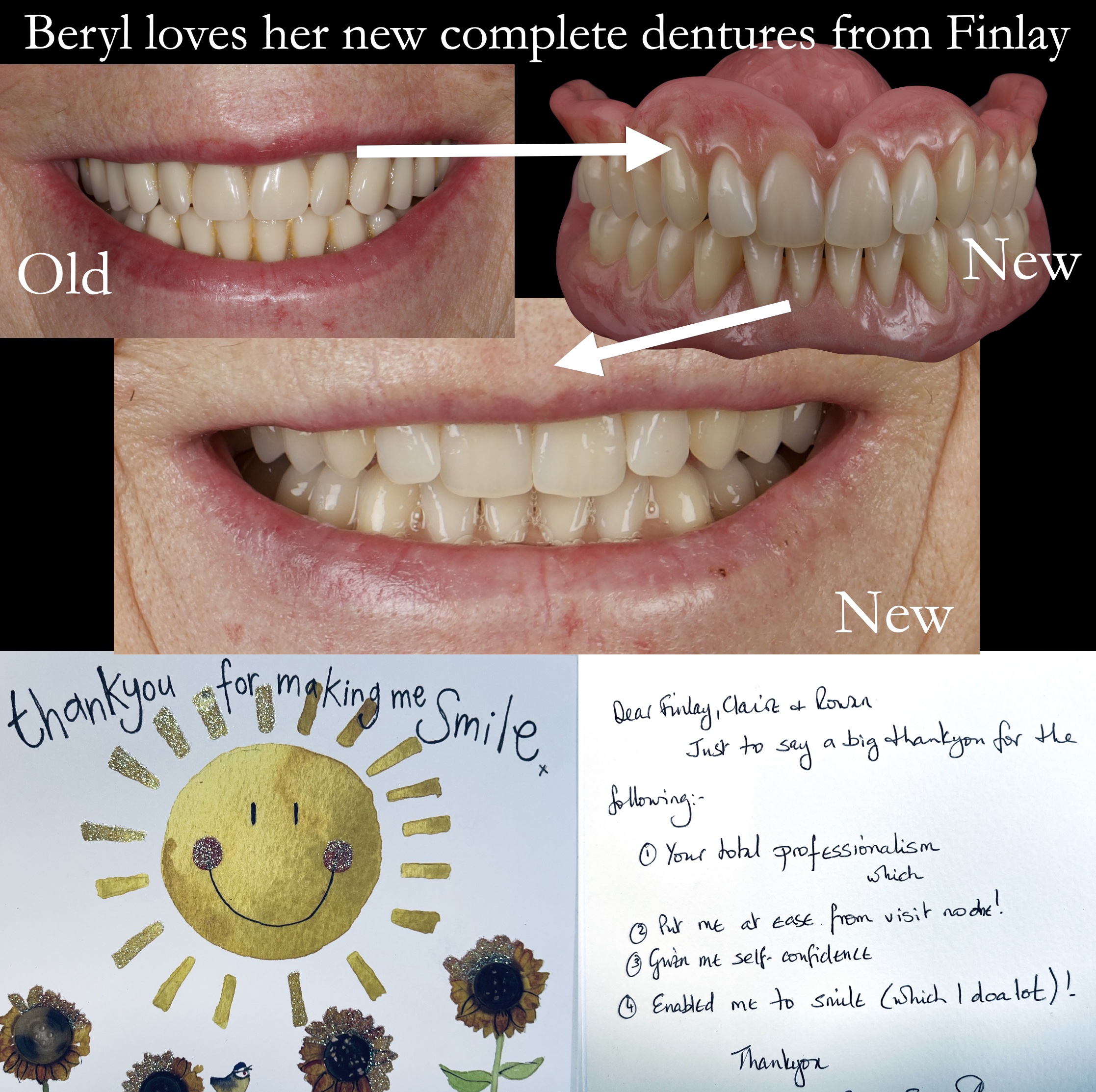 Beryl loves her new complete dentures from Finlay | Garstang Dental
